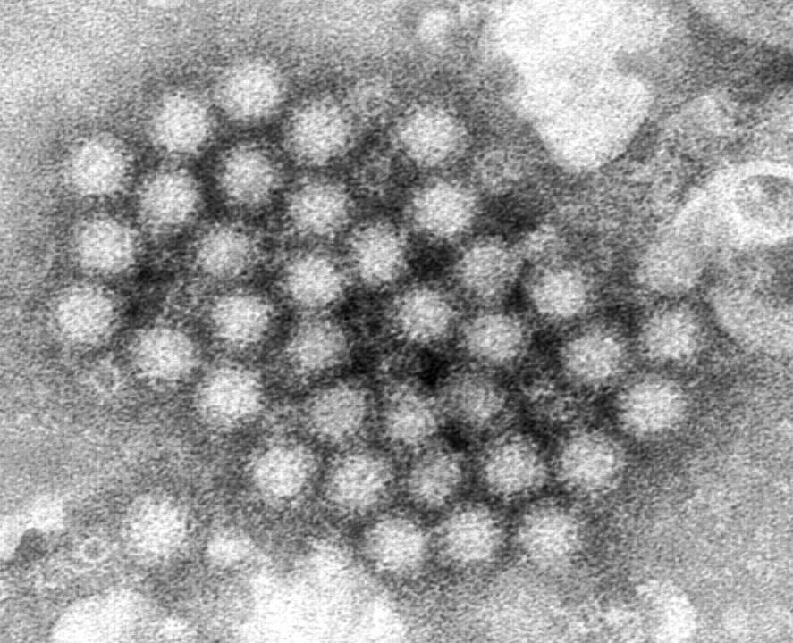 Highly contagious virus detected in New York wastewater