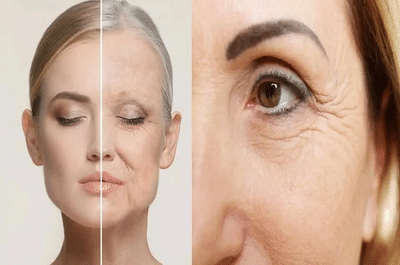Skin care tips - Are wrinkles bothering you? Eating these things will ...