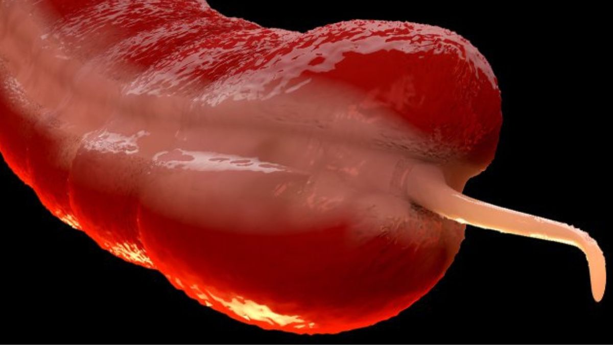 A rare cancer is surging in young people, and experts don't know why
