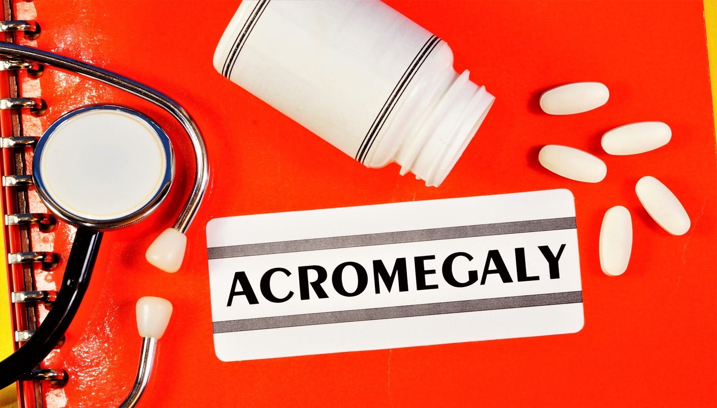 Debiopharm randomises first patient in phase III acromegaly trial