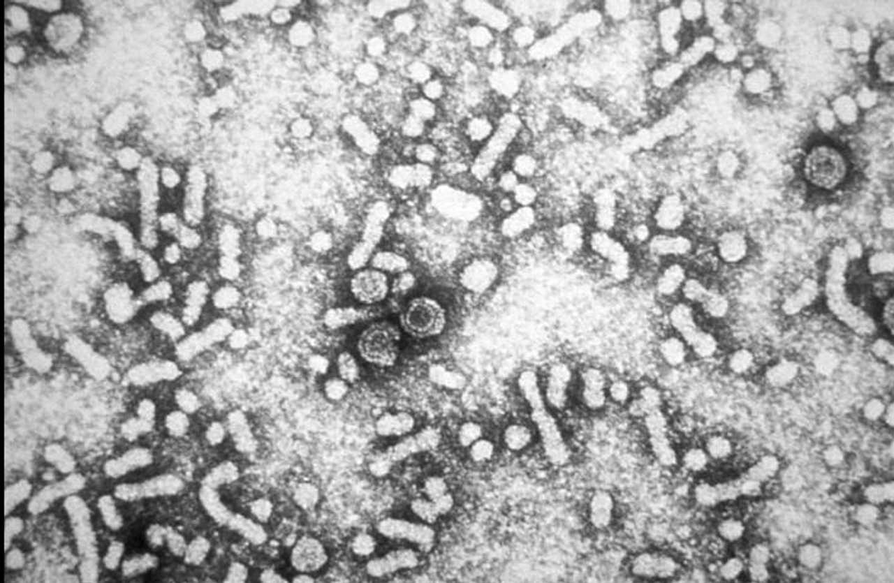 RFK Jr.-appointed CDC panel votes to drop hepatitis B vaccination ...