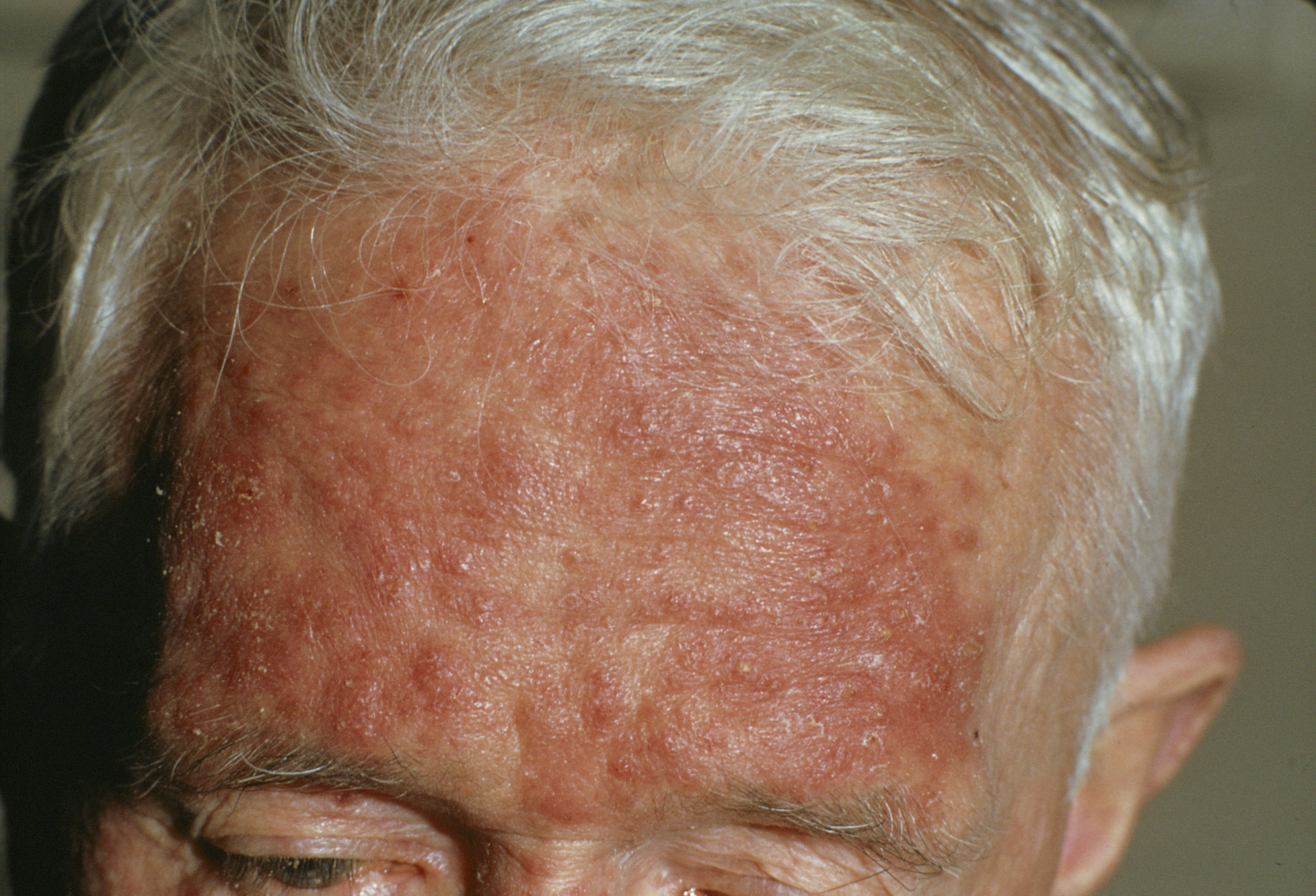 The most common skin conditions and their cures
