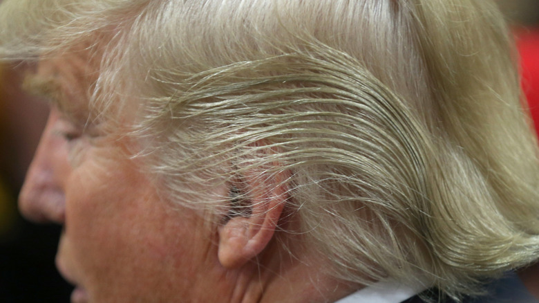 The hair loss drug Donald Trump used has some serious drawbacks