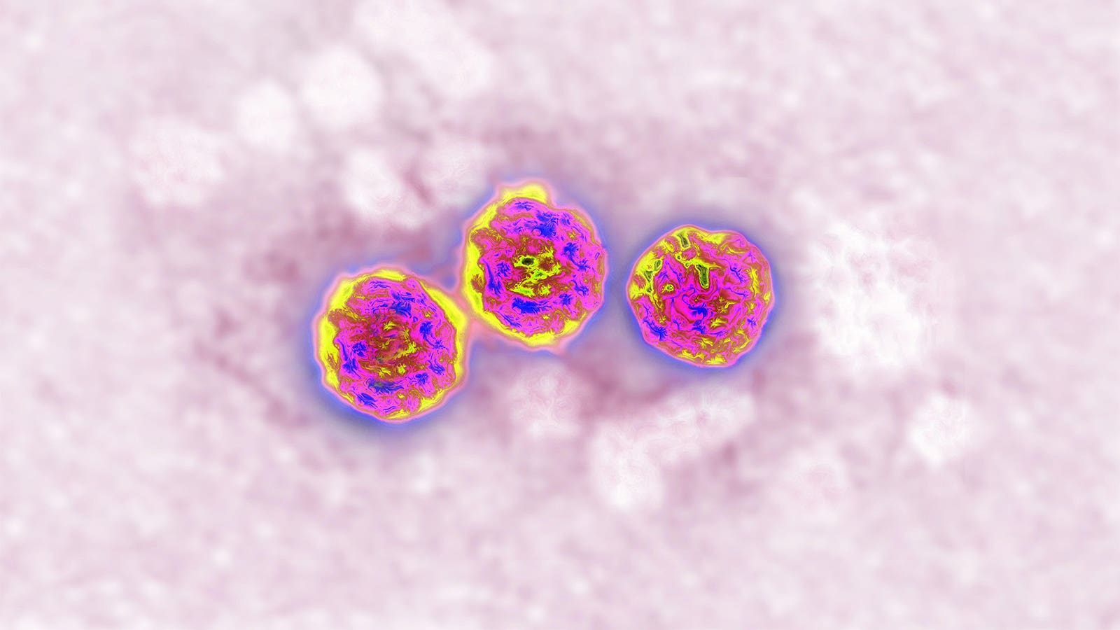 Resurrecting a global killer: ACIP's Hep B vote