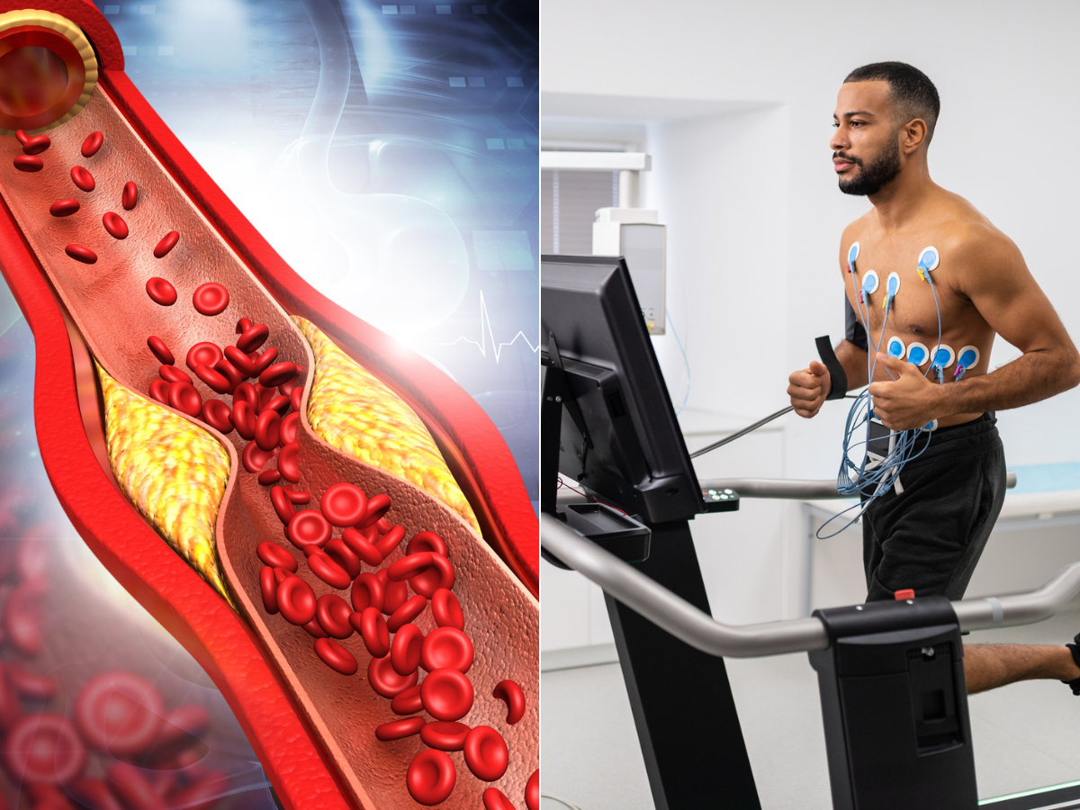 Heart attacks start in the artery wall, not the heart: Cardiologist ...