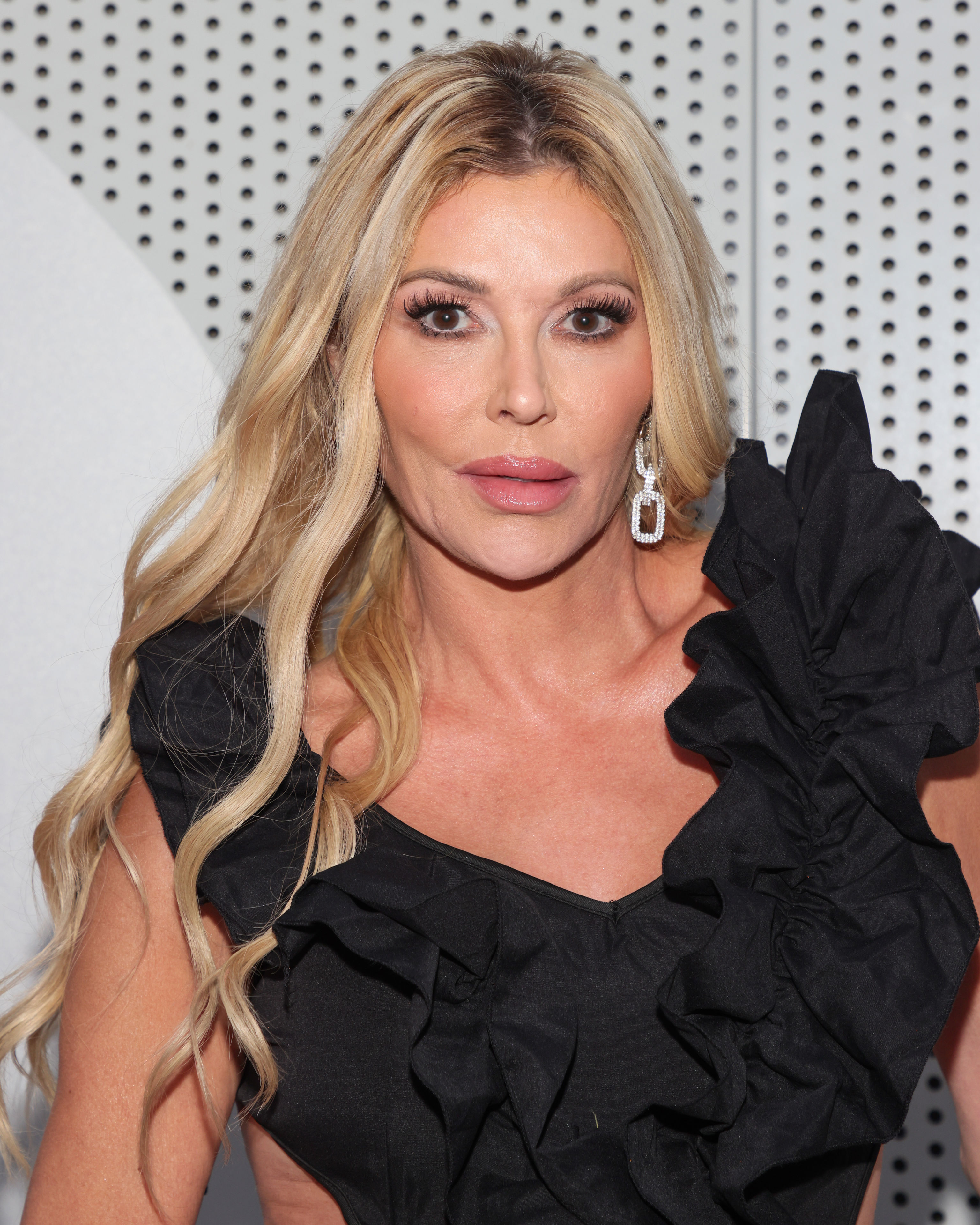Thrilled Brandi Glanville says she finally received diagnosis for face ...