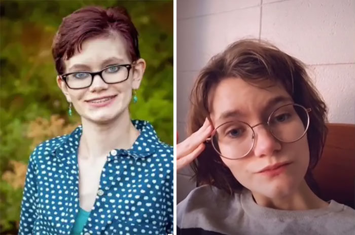 23 people share how they somehow managed to reverse age like Benjamin ...