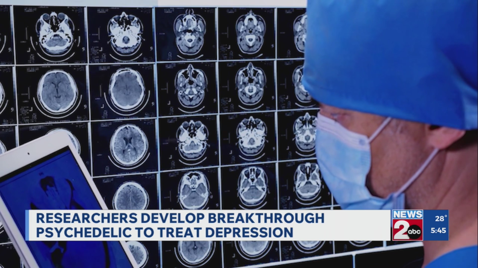 Researchers develop breakthrough psychedelic to treat depression