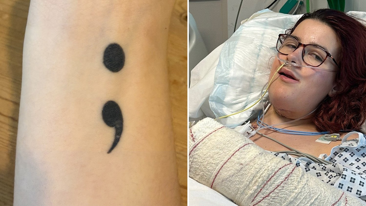 I got a tattoo on my arm — now it’s on my tongue