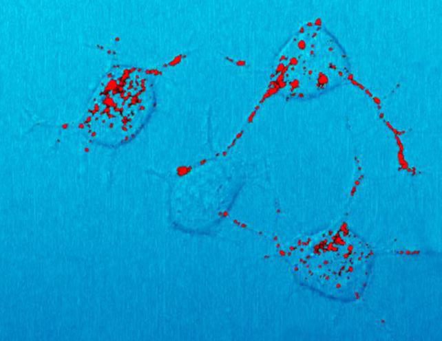 Prion-like brain damage can occur without infectious prions, study finds