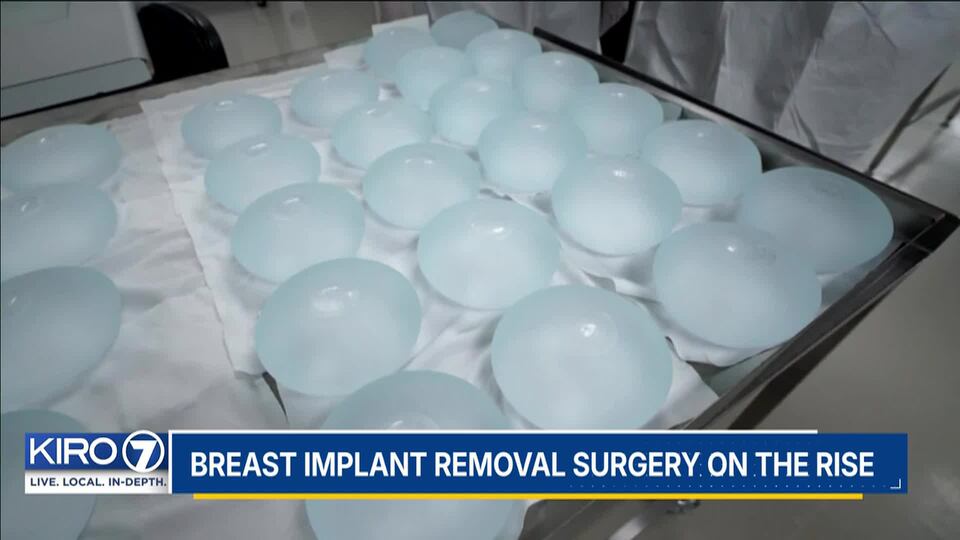 Video: Breast implant removal on the rise as illnesses increase
