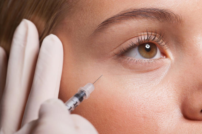Teens as young as 15 are scarred by botched Botox