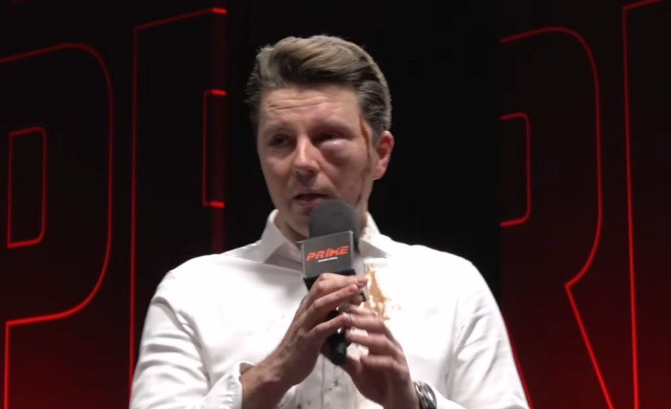 Korczarowski z podbitym okiem na konferencji. Pobił go Jaś Kapela