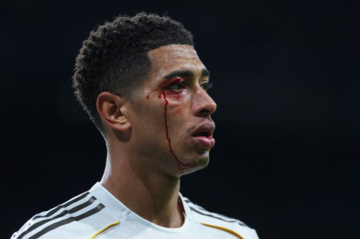 Bellingham suffers horror cut as nine-man Real Madrid slump to defeat