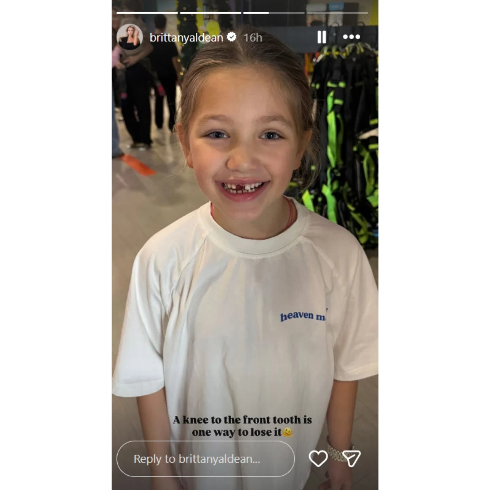 Jason Aldean’s daughter loses first tooth thanks to a knee to the mouth ...