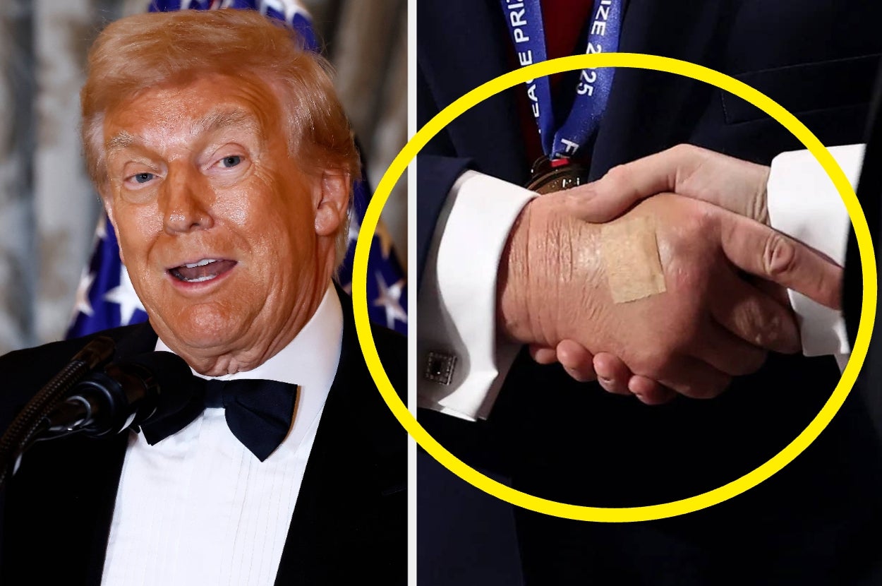 Amid months of health rumors, Donald Trump's hand looks really, really ...