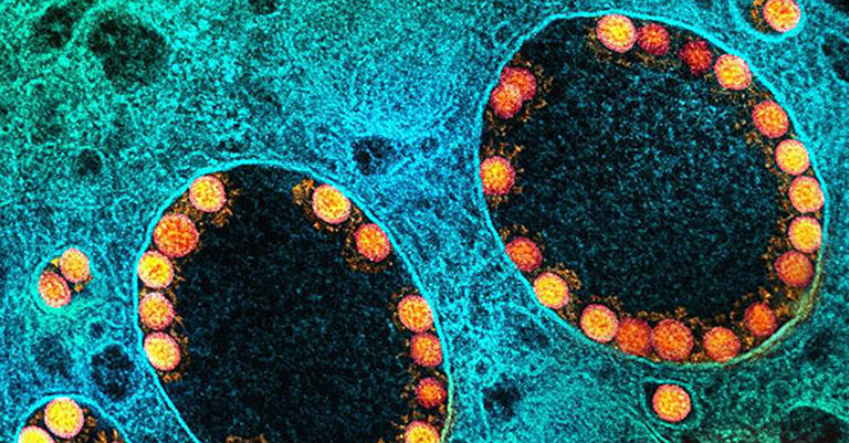 Older chemical libraries show promise for fighting resistant strains of ...