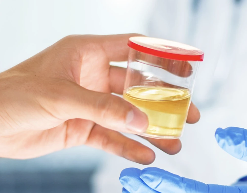 Powdered vs premixed synthetic urine in 2025: Why many users prefer ...