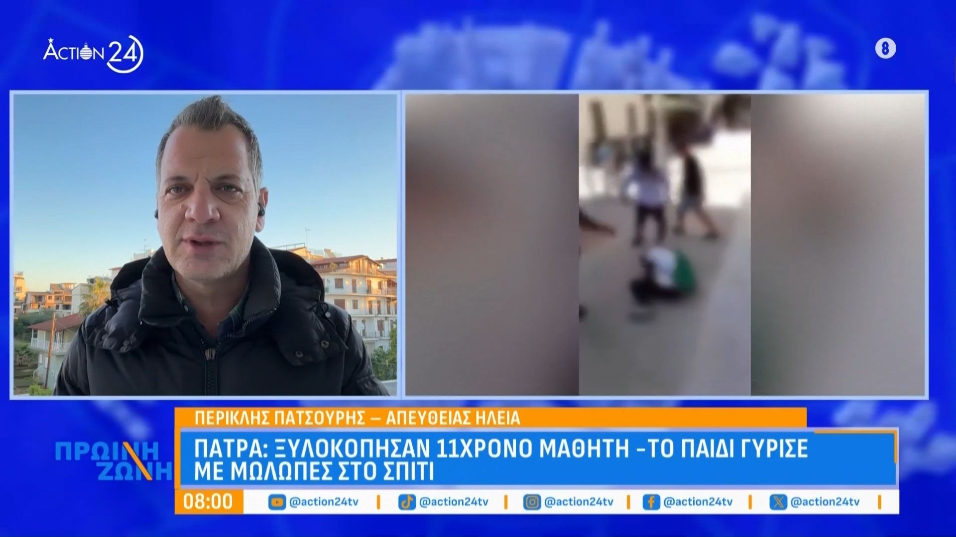 Πάτρα: Ξυλοκόπησαν 11χρονο μαθητή – Το παιδί γύρισε με μώλωπες στο σπίτι