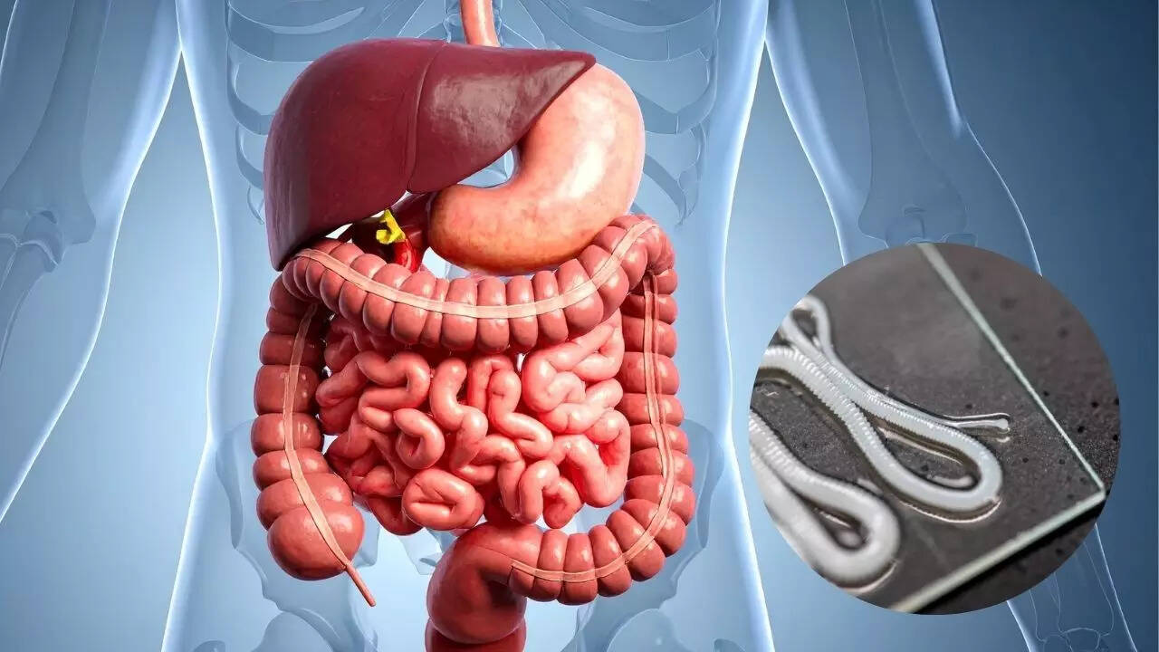 Spotting worms in your poop: How to identify the types, causes, and ...