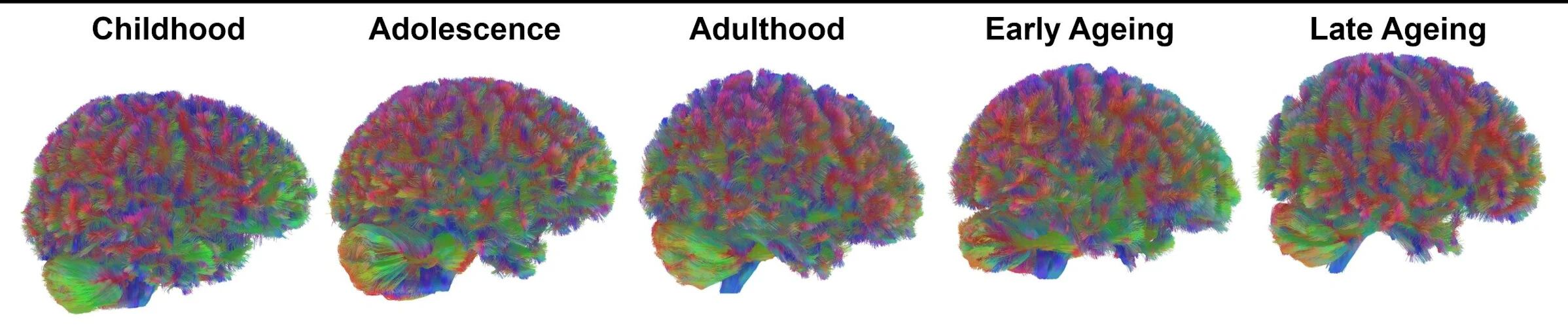 Brain Changes at 9, 32, 66, 83