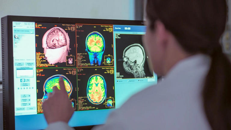 Human Brain Undergoes Rapid Changes at 9, 32, 66, 83