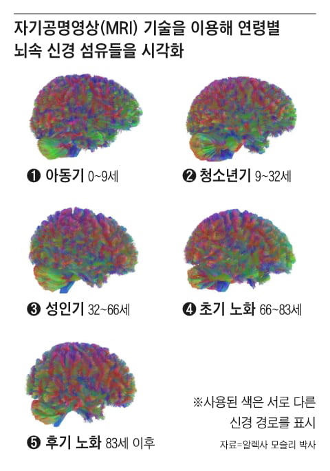 Human Brain Undergoes Rapid Changes at 9, 32, 66, 83