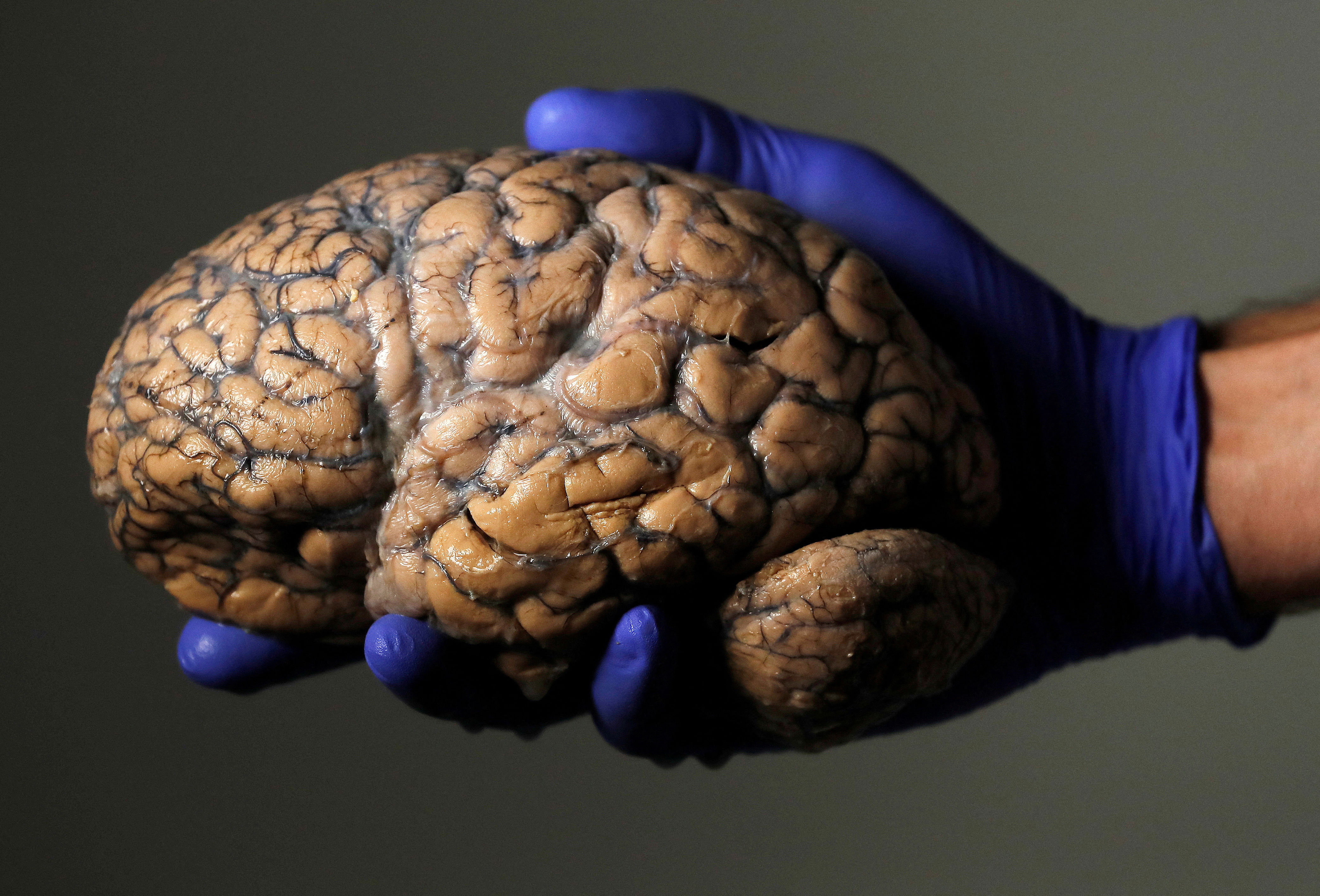 Does adolescence last until 32? Scientists unlock brain’s five eras