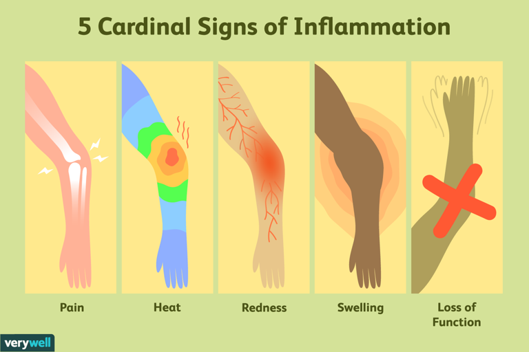 Signs of inflammation and common treatments