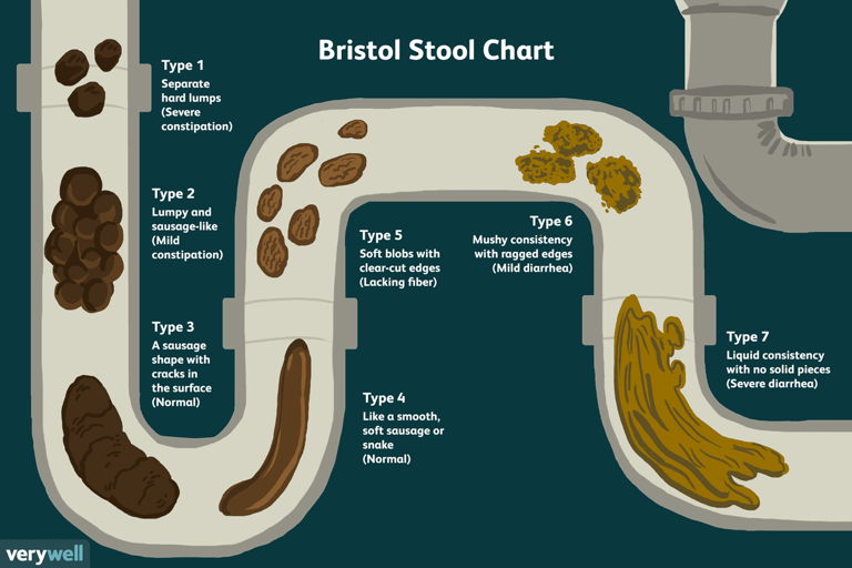Understanding poop types with the Bristol stool chart
