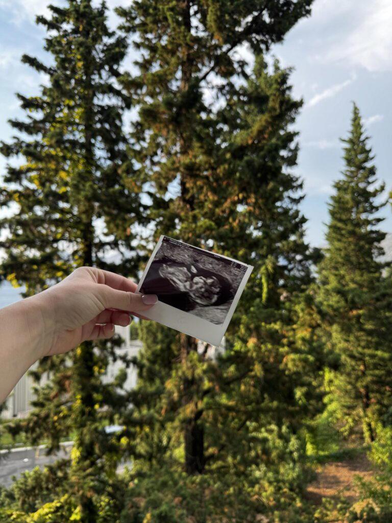 Mum warns of private scan risks after three clinics failed to spot ...