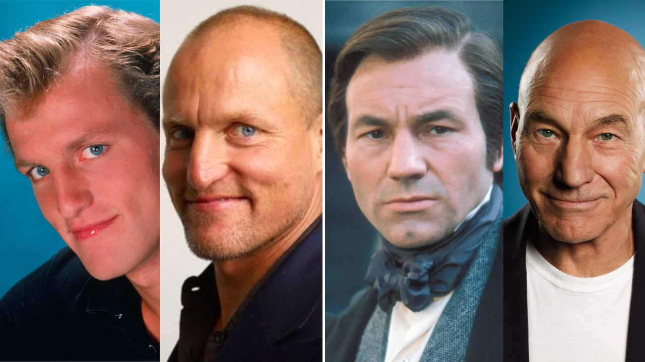 15 Photos of Bald Celebrities When They Had Hair