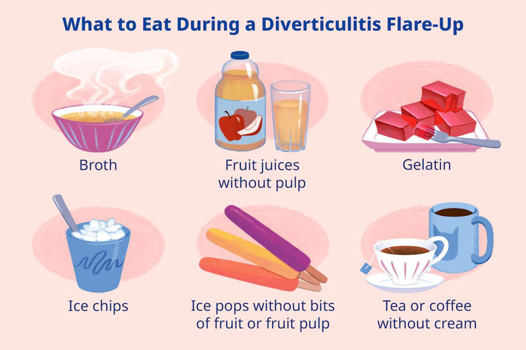 Diverticulitis diet for flare-ups, recovery, and prevention