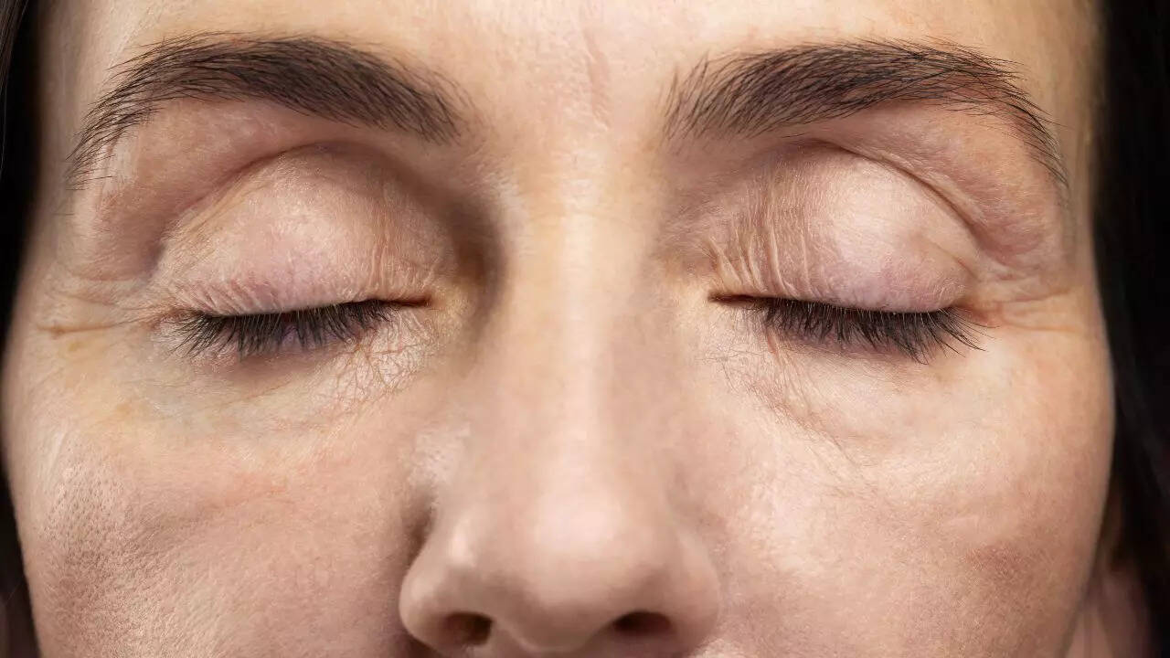 What your eyelashes say about your overall health: 4 conditions you ...