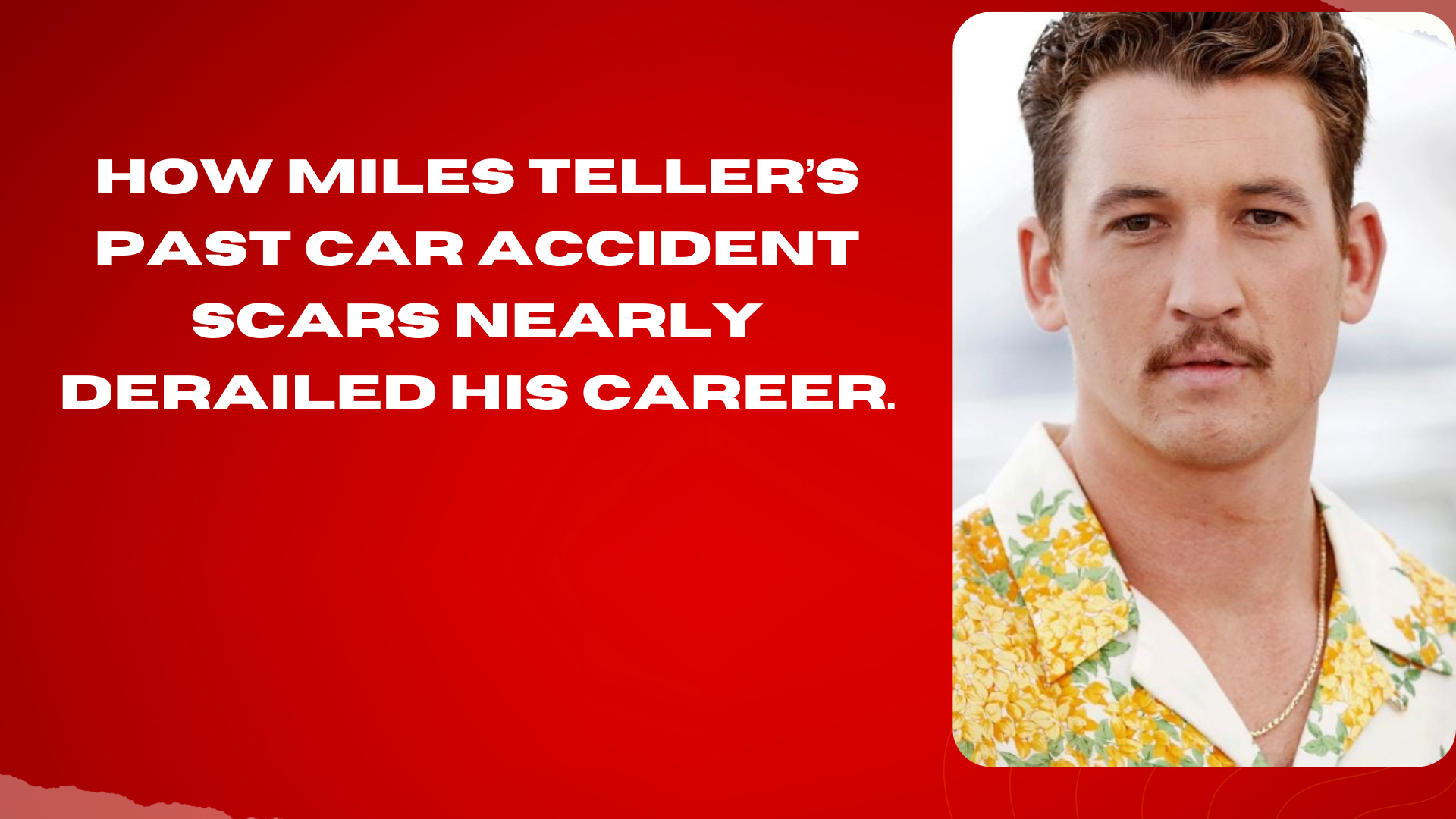 How Miles Teller’s Past Car Accident Scars Nearly Derailed His Career.