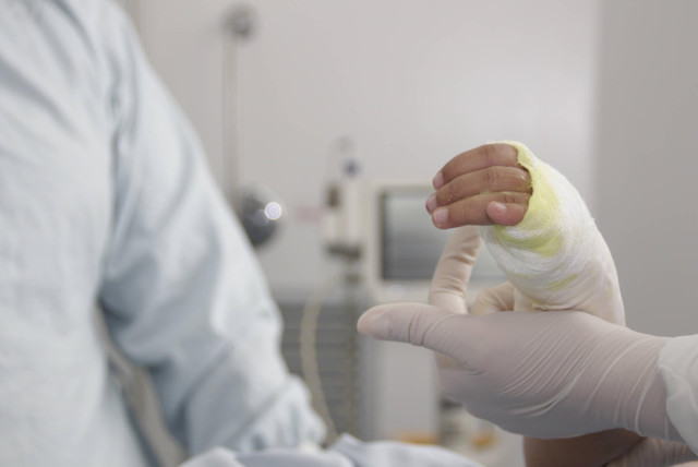 Antioquia se queda sin camas para quemados tras una noche de Navidad ...