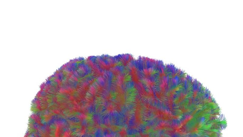 How does the brain rewire itself — and when?