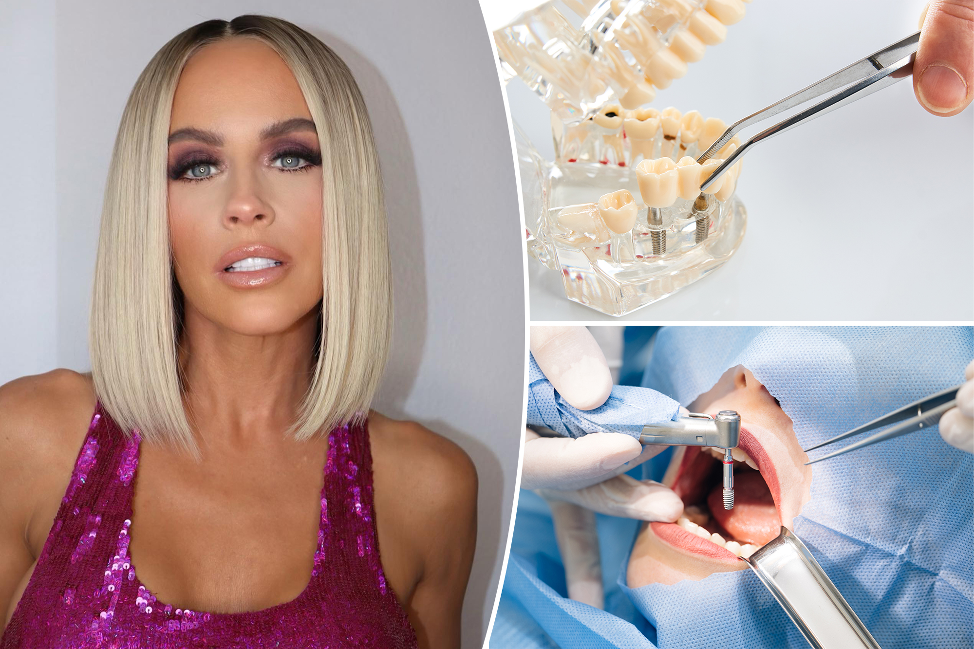 How do dental implants fail? Inside Jenny McCarthy’s ‘pretty unlucky ...