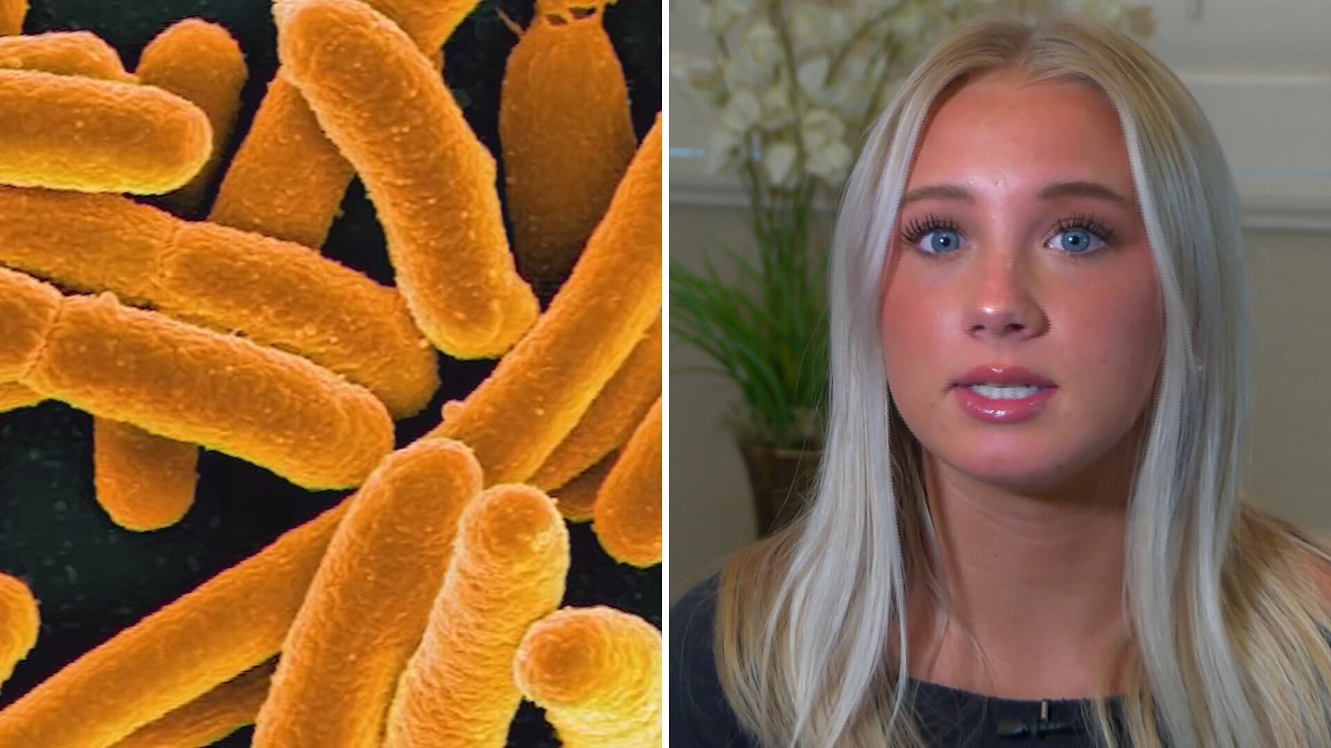 E. coli outbreak sickens Arizona teen; health officials work to ...