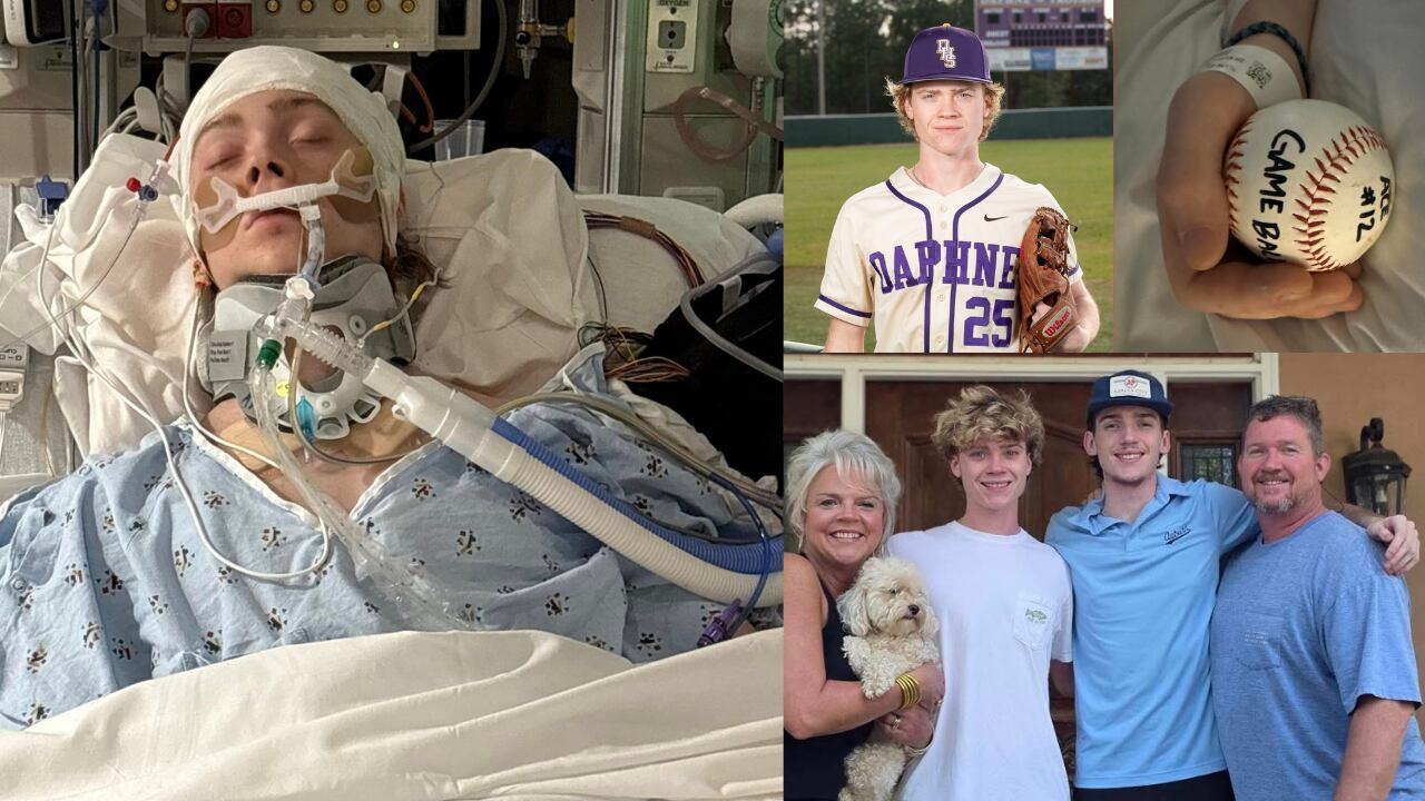 ‘Let’s go, son:’ Daphne teen fights to recover from traumatic brain ...