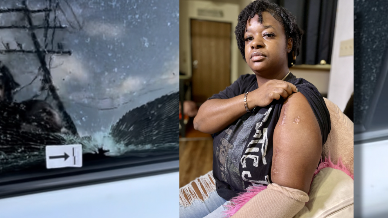Road rage shooting victim warns MKE drivers after being shot for ...