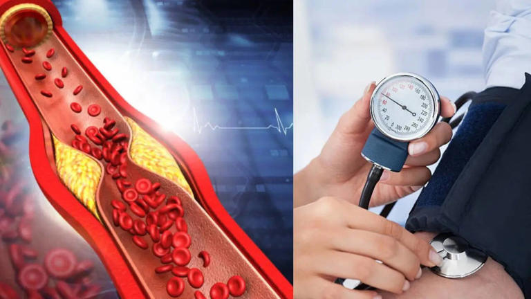 How Often to Check Your BP at Home: The Surprising Answer from a ...
