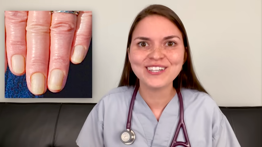 Top 10 nail problems that could signal serious health issues