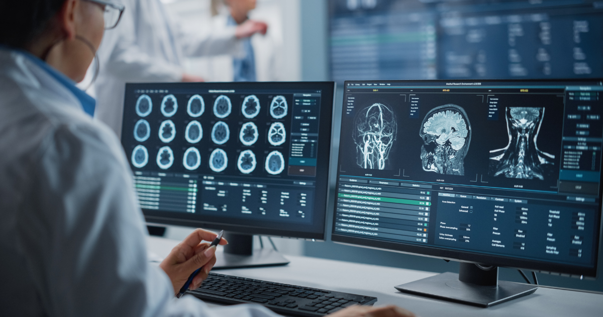 New study says brain stays in adolescent stage until age 32