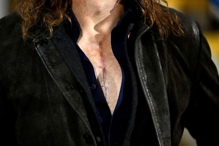 Two months on from open heart surgery, Gillingham manager Gareth ...