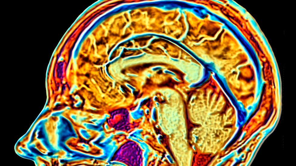 Weekly quiz: What age did scientists say your brain reaches adulthood?