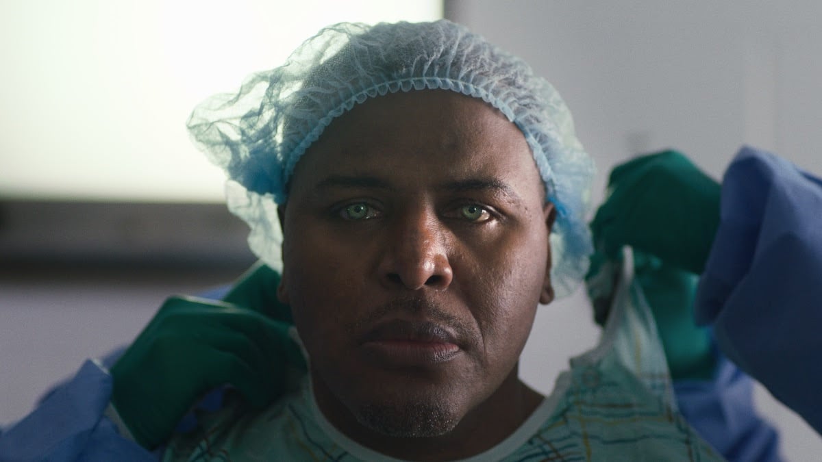 Biracial Man’s Experiences With Racism Lead Him To Risky Procedure To ...