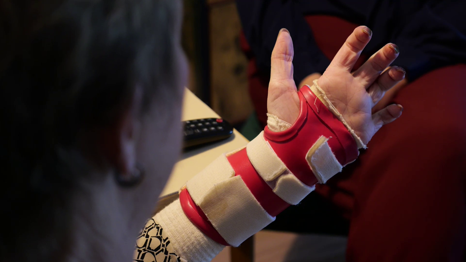 How do you get a hand transplant?