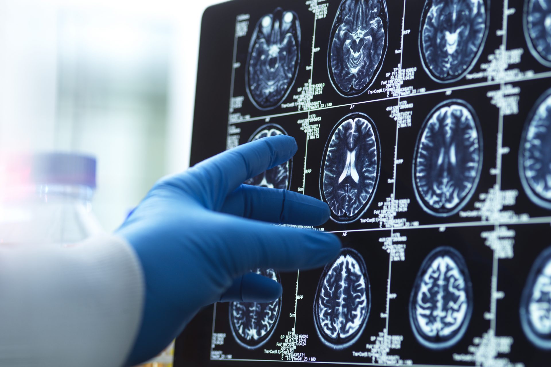 The five journeys our brains take in a lifetime, according to a new study