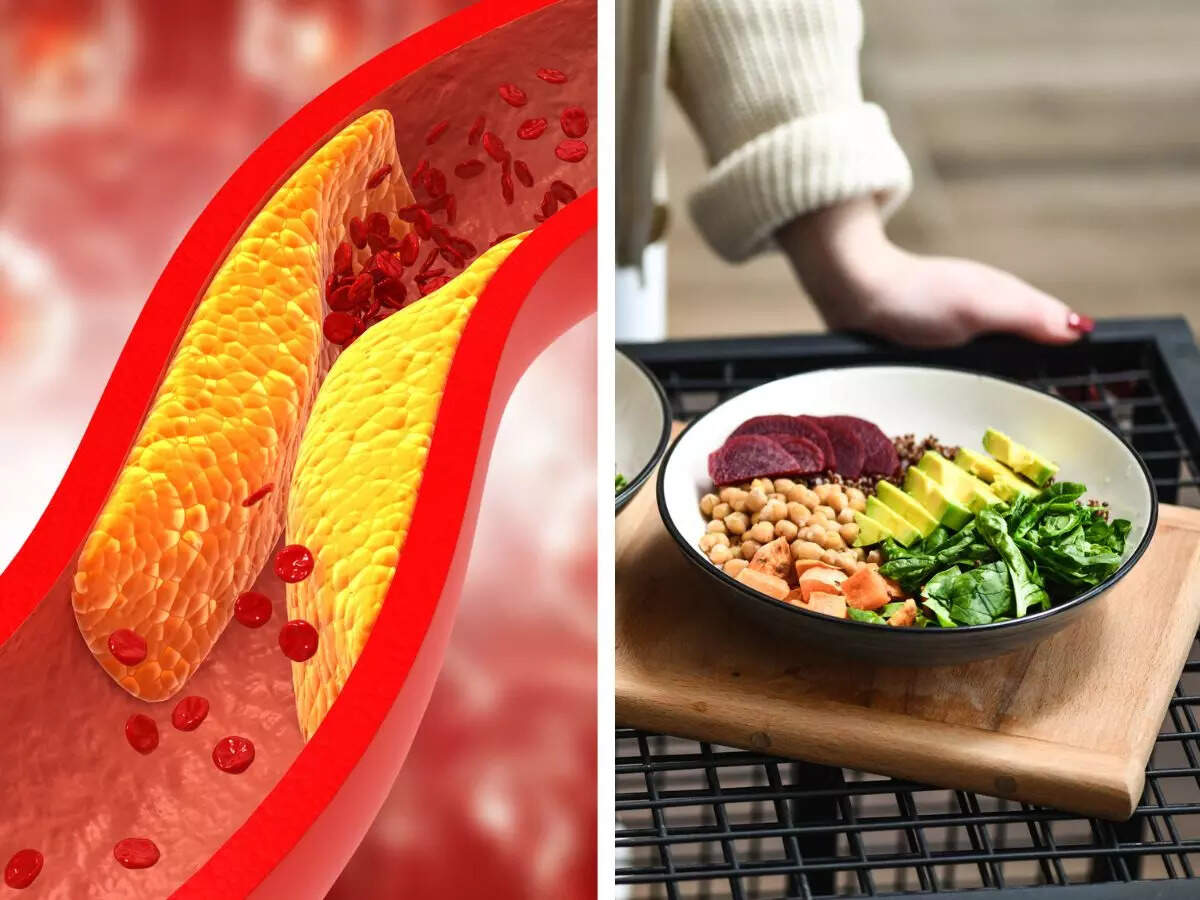 4 vascular-surgeon-recommended steps to keep arteries clean and healthy